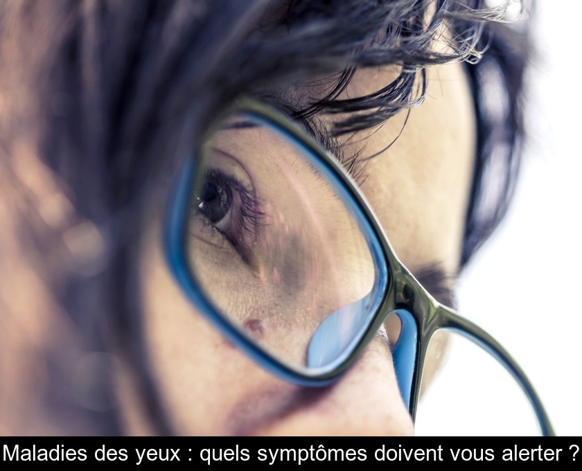 Maladies des yeux : quels symptômes doivent vous alerter